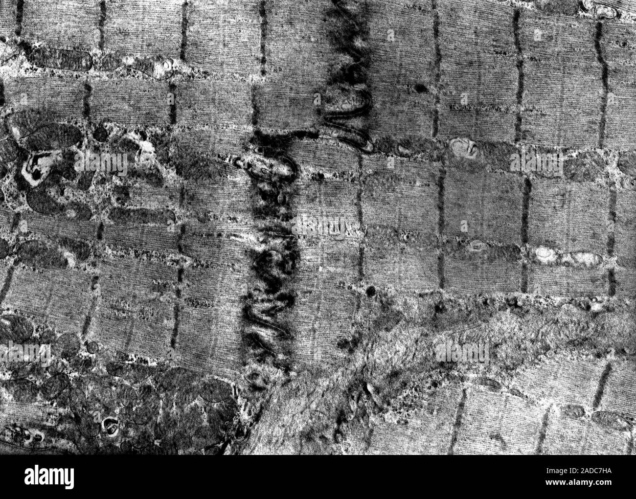 Transmission electron micrograph (TEM) showing two heart muscle cells joined by an intercalated ...