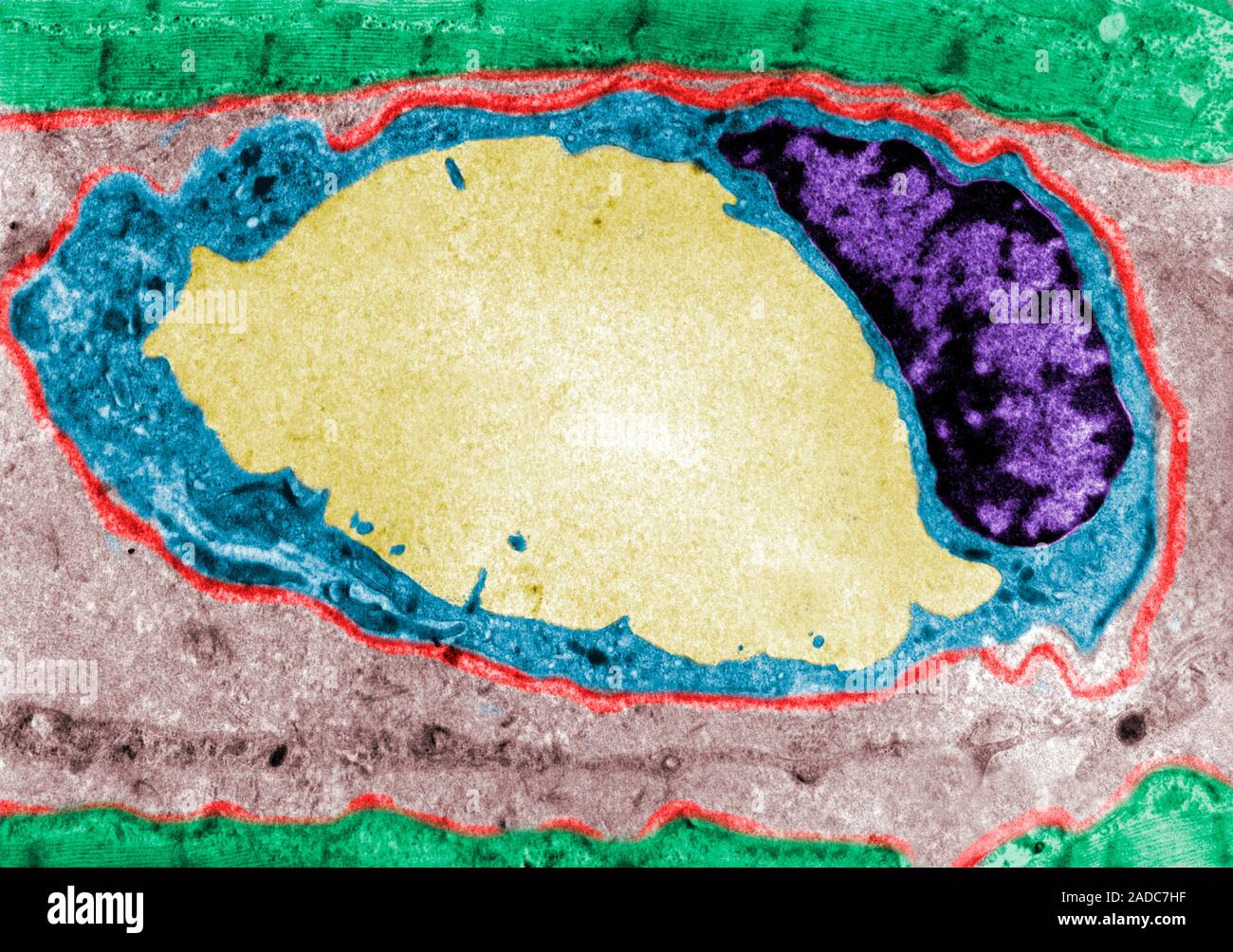 False colour transmission electron micrograph (TEM) showing a capillary ...