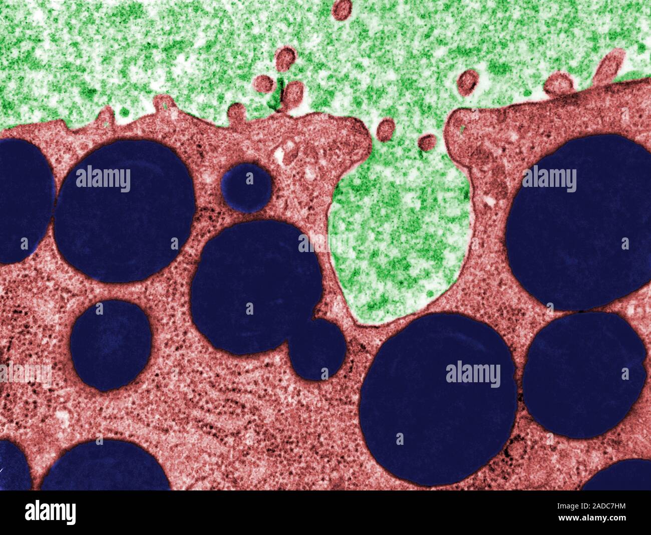 False colour transmission electron micrograph (TEM) showing several ...