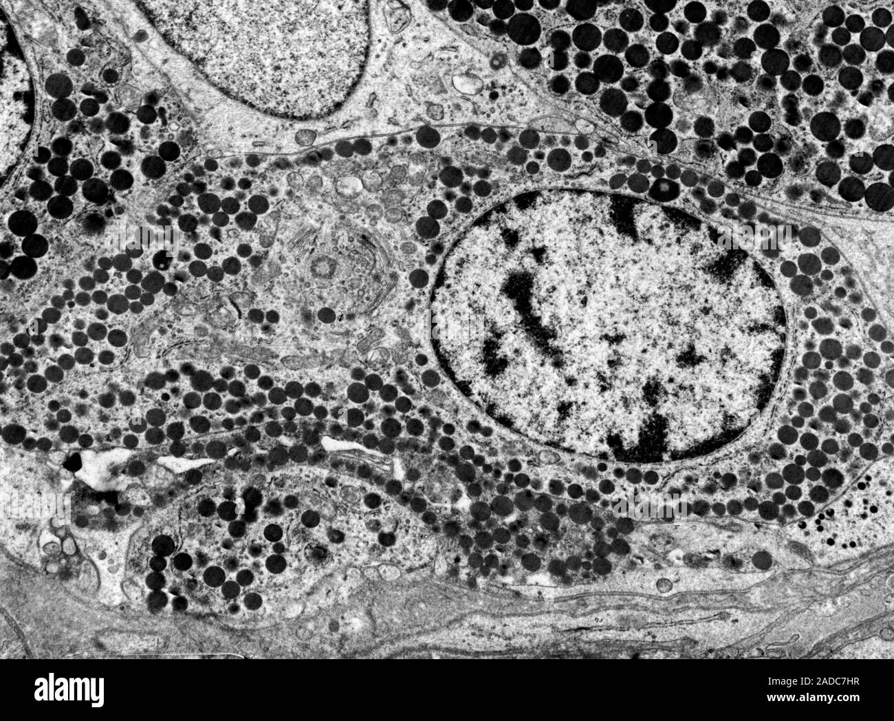 Transmission electron micrograph (TEM) showing several endocrine cells ...