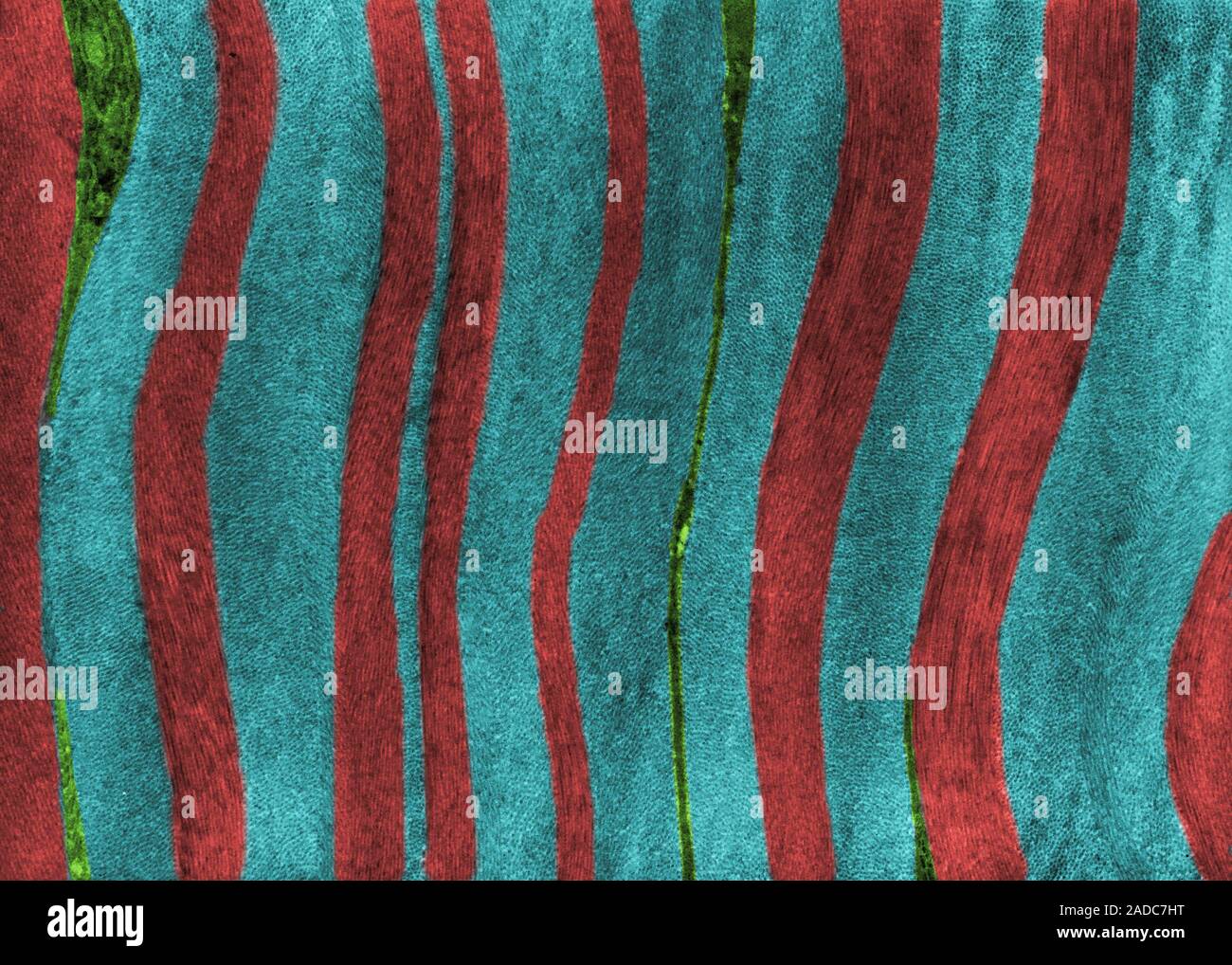 False colour transmission electron micrograph (TEM) showing the typical ...