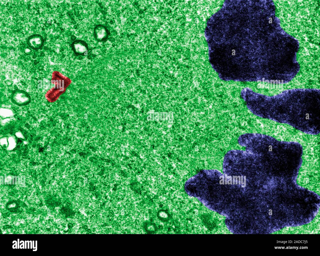 False colour transmission electron micrograph (TEM) showing metaphase ...