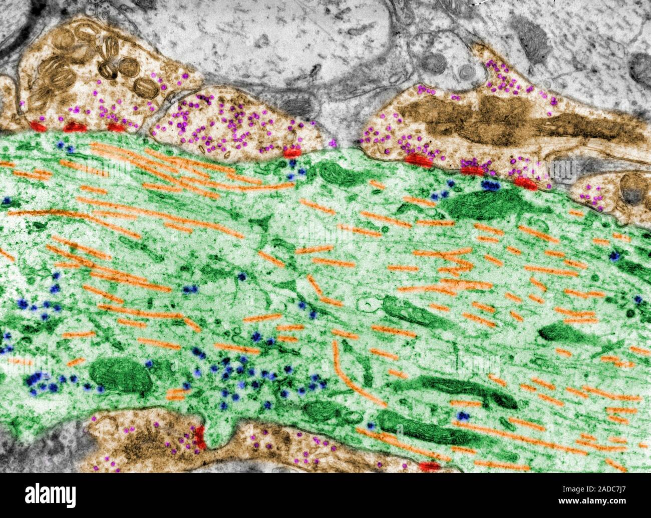 False Colour Transmission Electron Micrograph Tem Showing A Dendrite Green Surrounded By