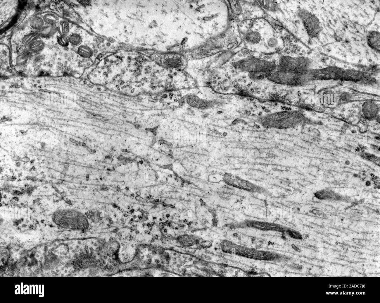 Transmission Electron Micrograph Tem Showing A Dendrite Surrounded By Several Axons Making