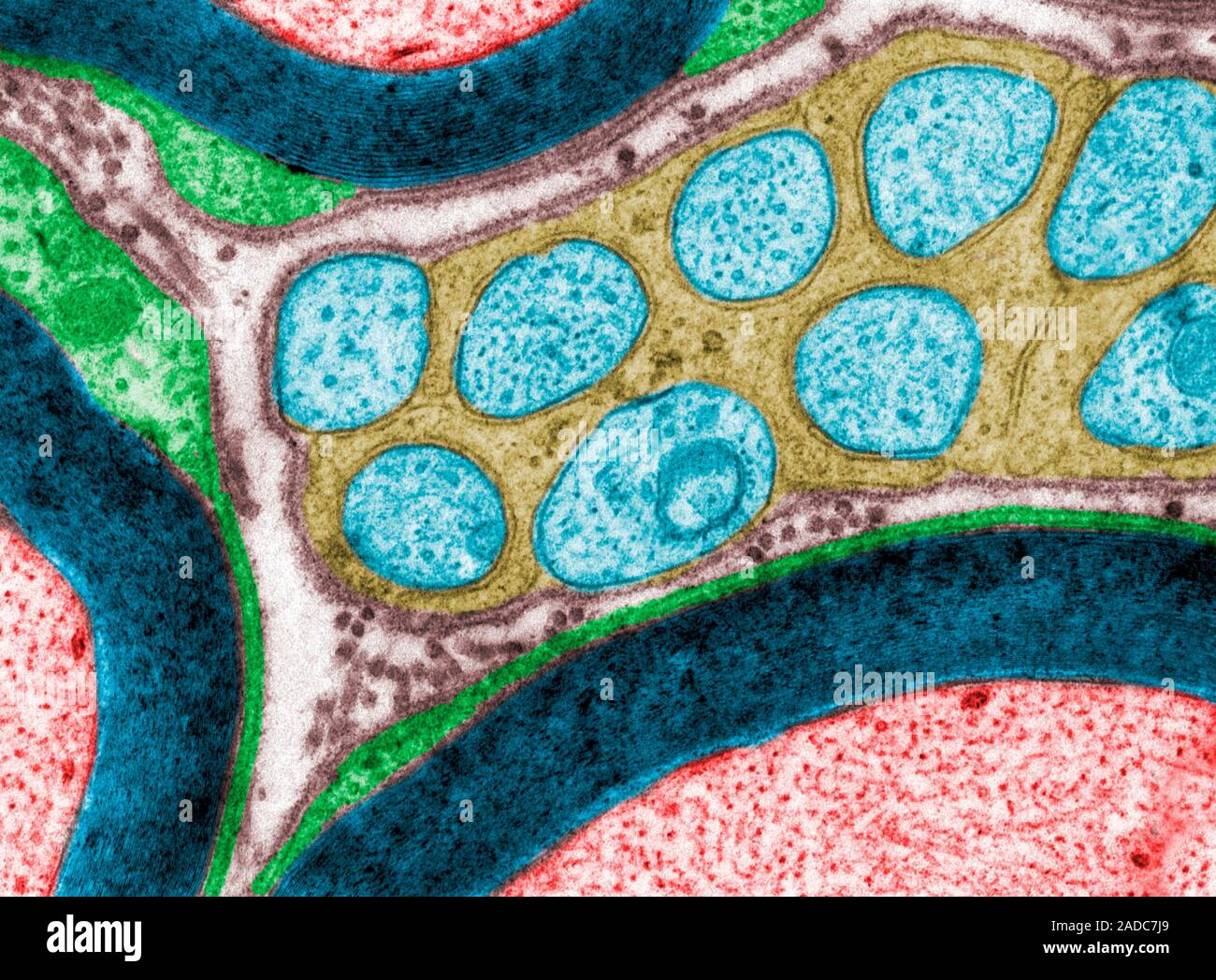 False colour transmission electron micrograph (TEM) showing several ...