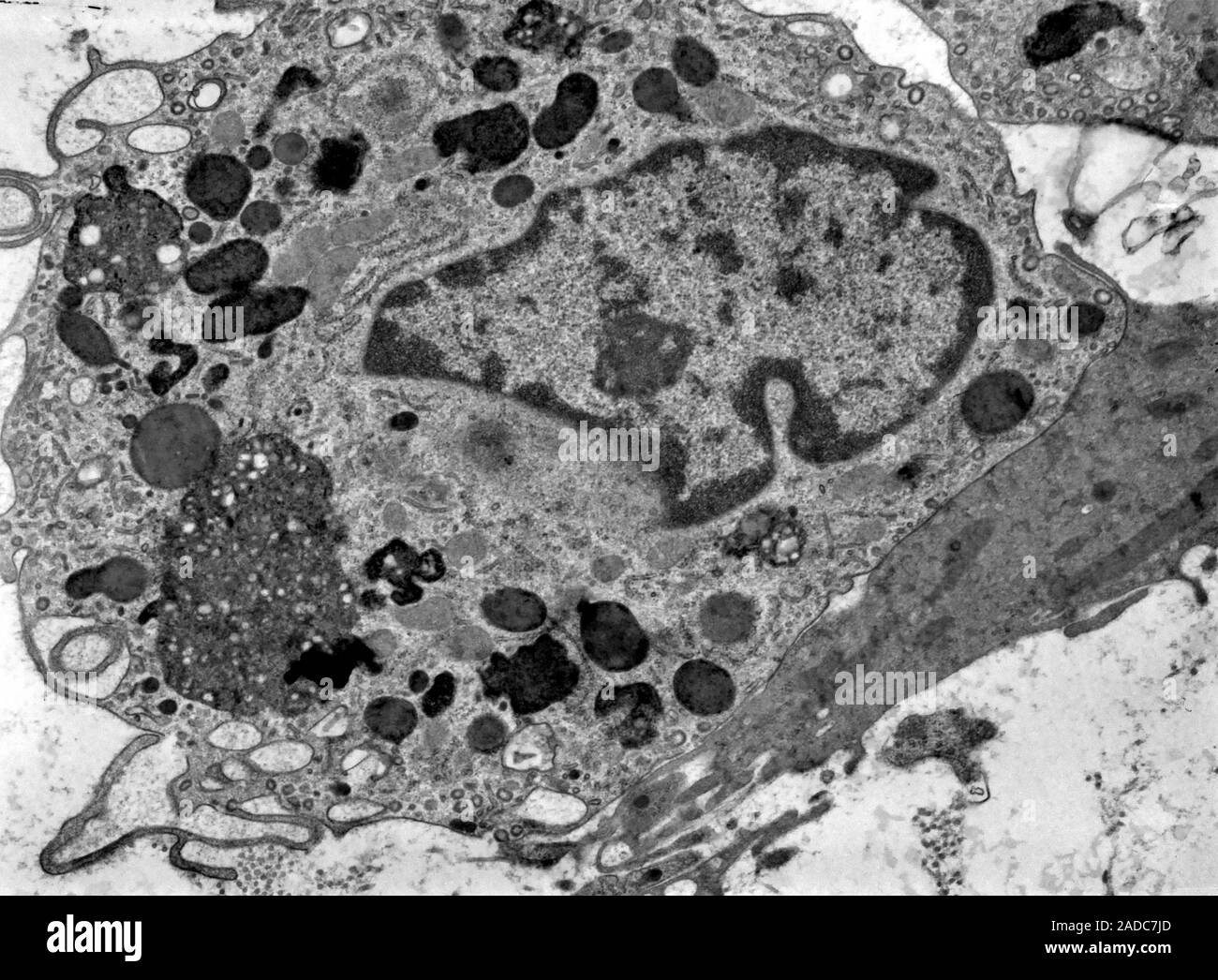 Transmission electron micrograph (TEM) showing a macrophage. The ...