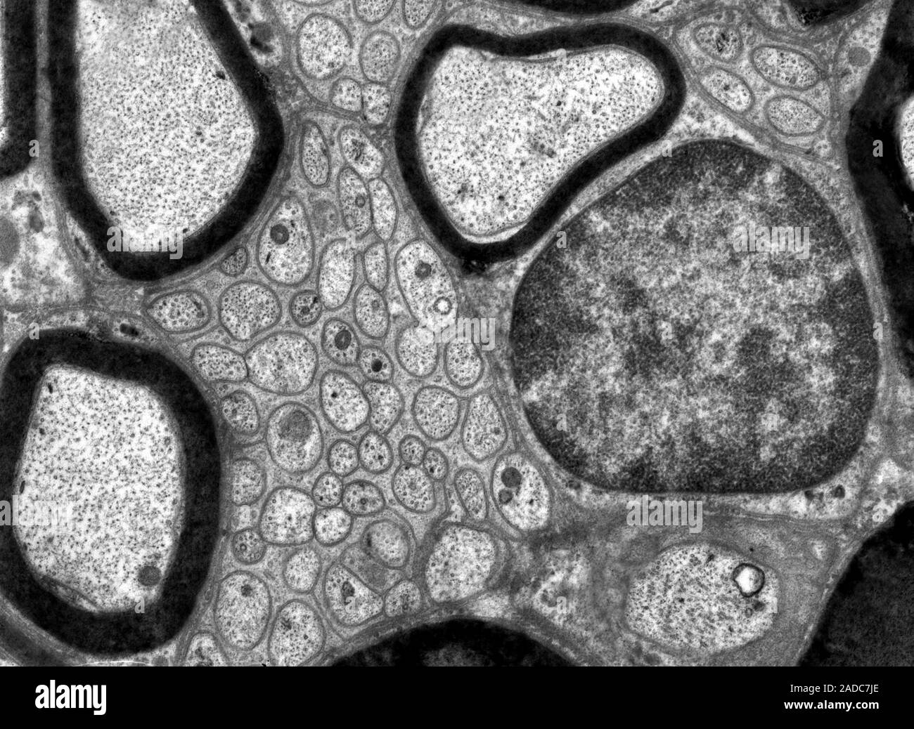 Transmission electron micrograph (TEM) of several peripheral ...