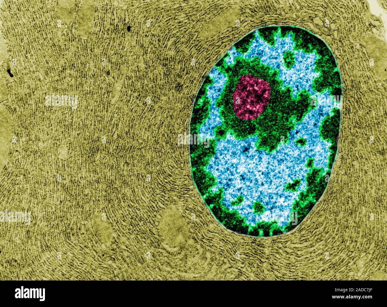 False colour transmission electron micrograph (TEM) showing a serous ...