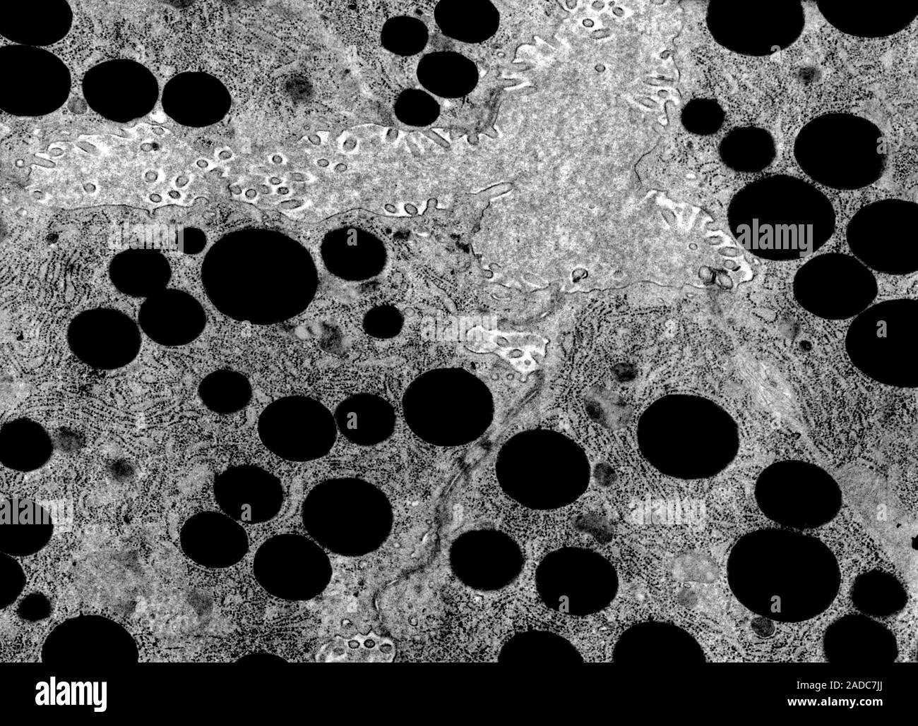 Transmission electron micrograph (TEM) showing the central zone of a ...