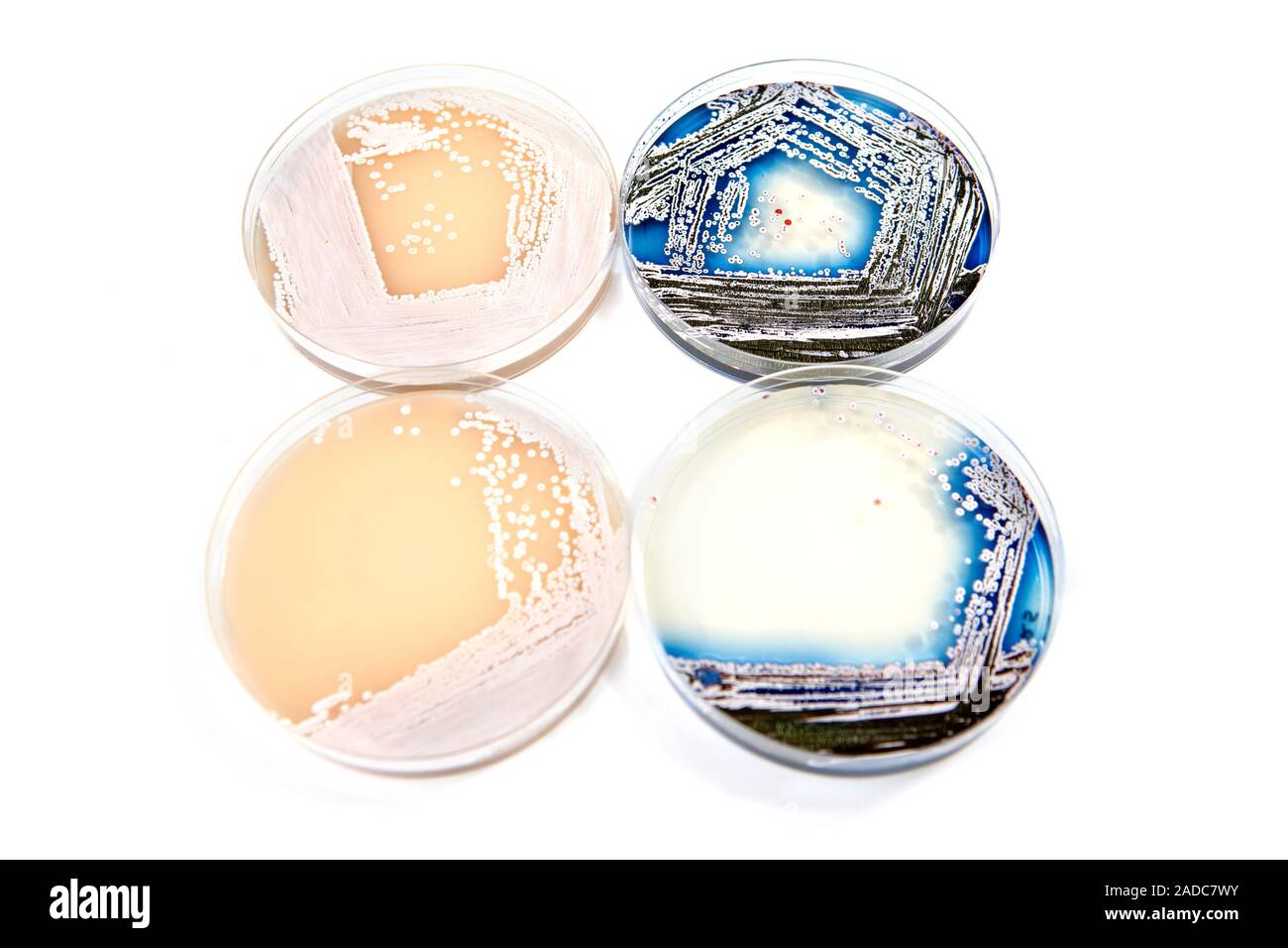 Streptomyces coelicolor bacterial cultures. Petri dishes containing a ...