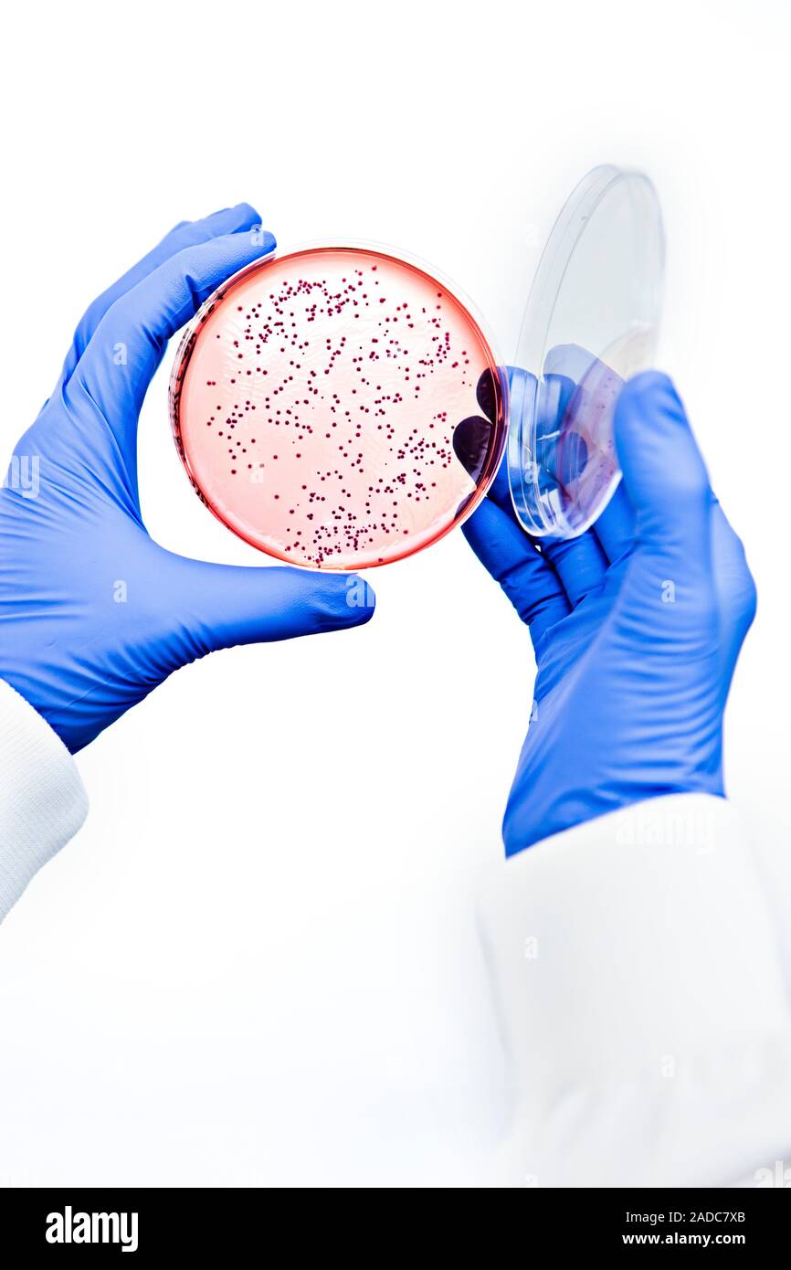 E. coli bacterial culture. Close-up of a microbiologist holding a petri ...