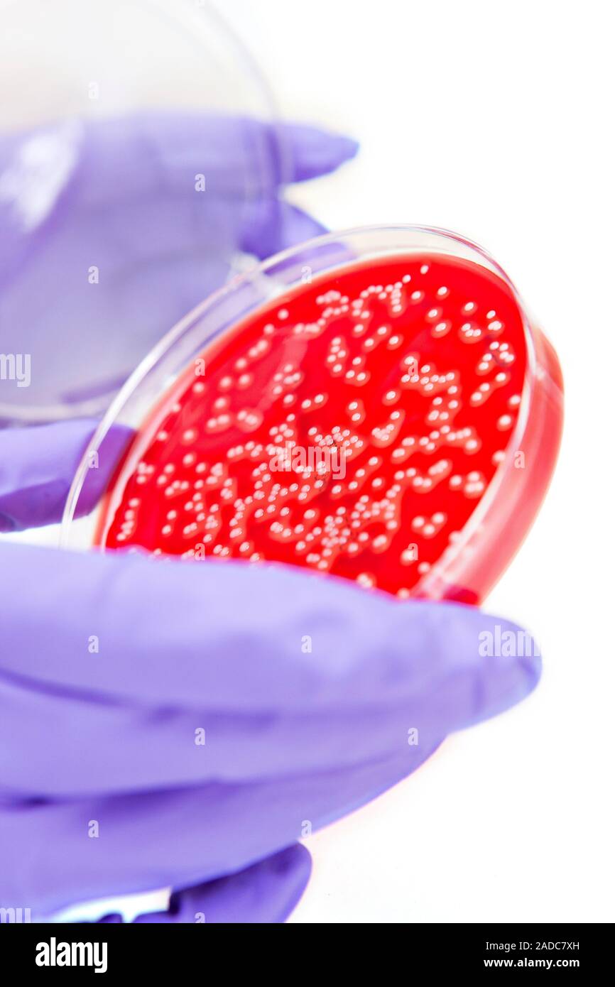 E. coli bacterial culture. Microbiologist holding a petri dish ...