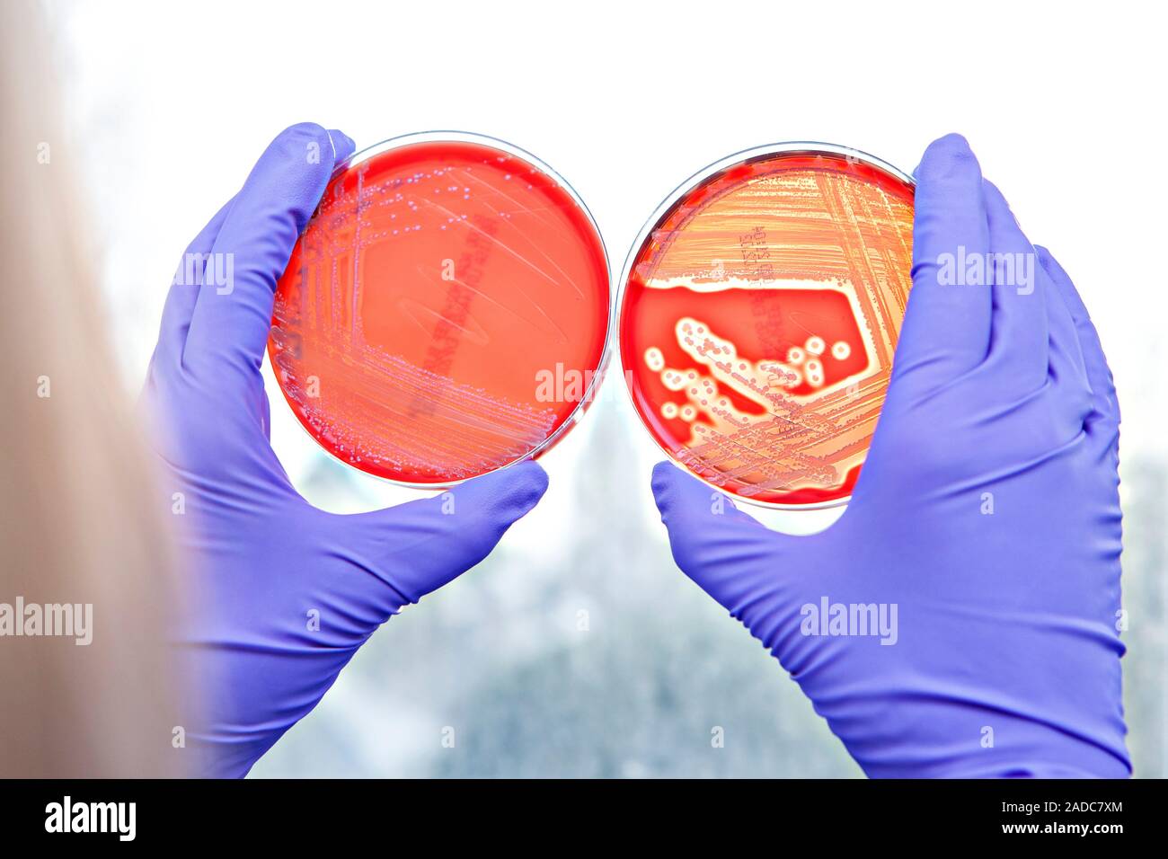 E. coli bacterial cultures. Microbiologist holding petri dishes ...