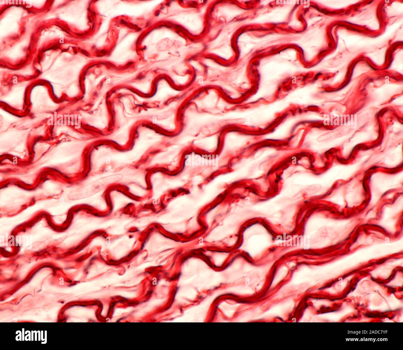 High magnification light micrograph of the tunica media of an elastic ...