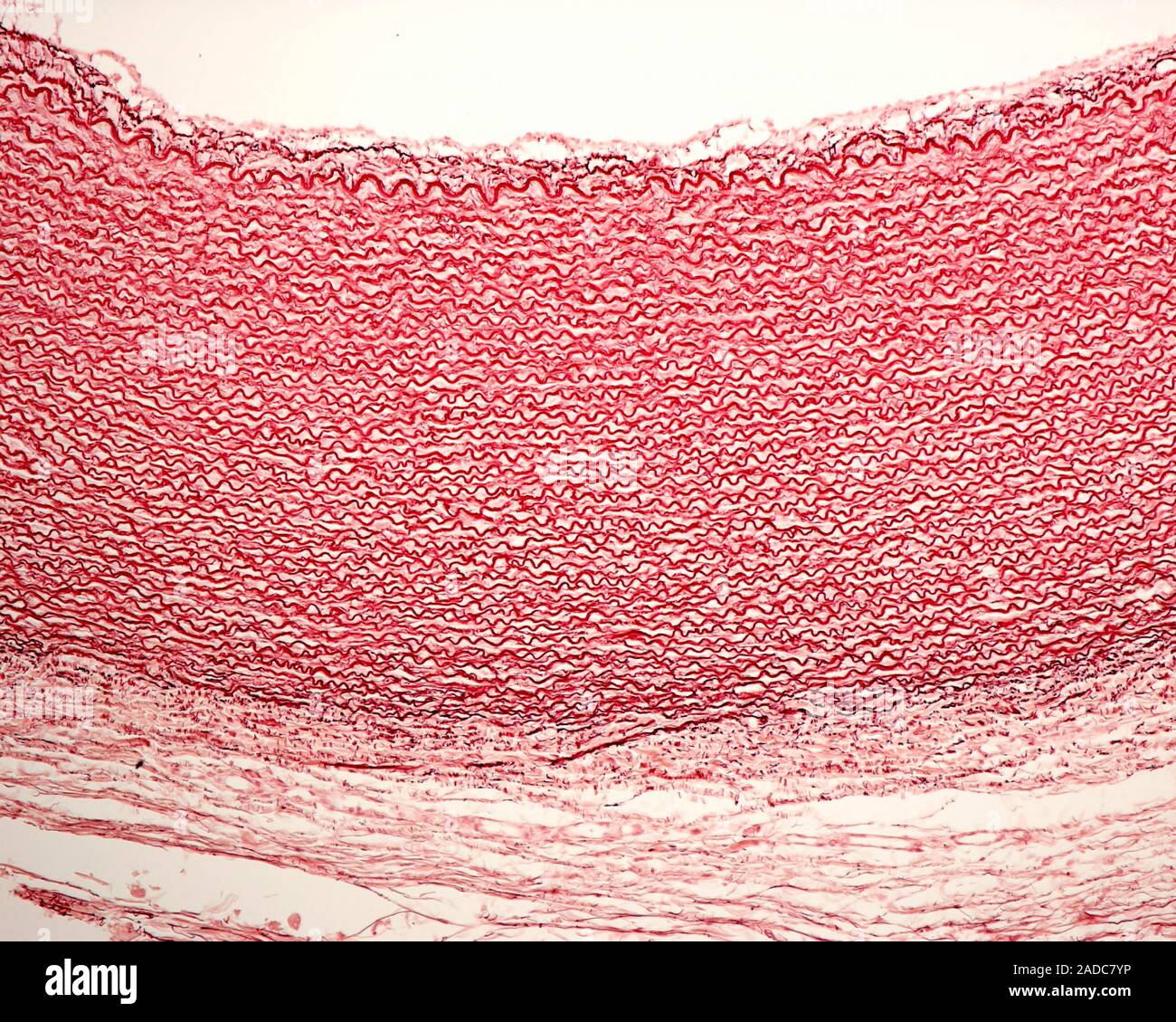 Cross-section of a human aorta showing the layers of its wall, light ...