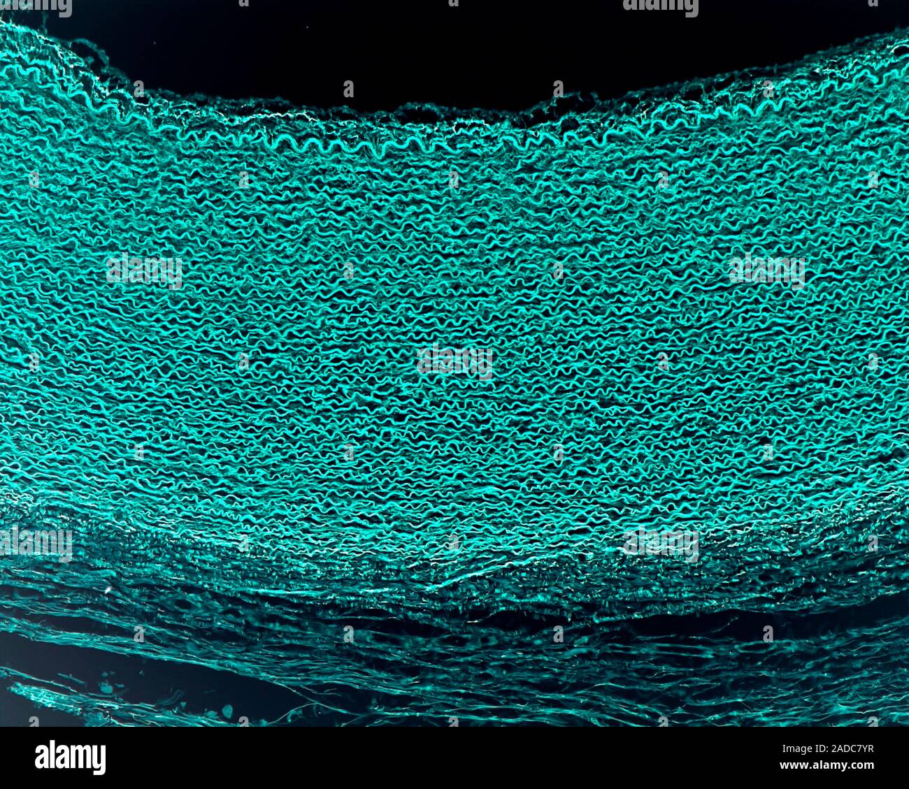 Cross-section of a human aorta showing the layers of its wall, light ...