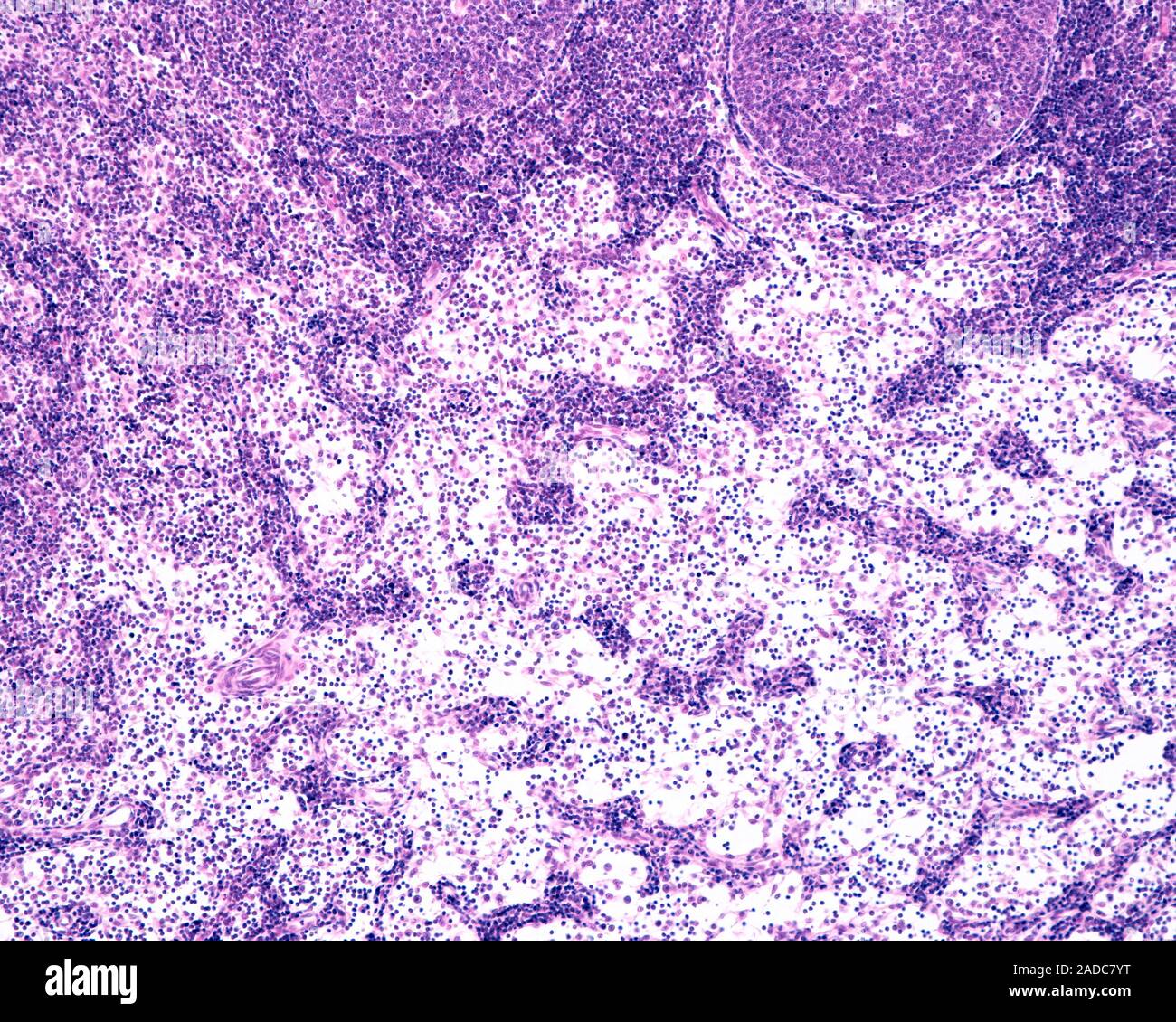 Light micrograph of the para cortex and medulla of a lymph node. The ...