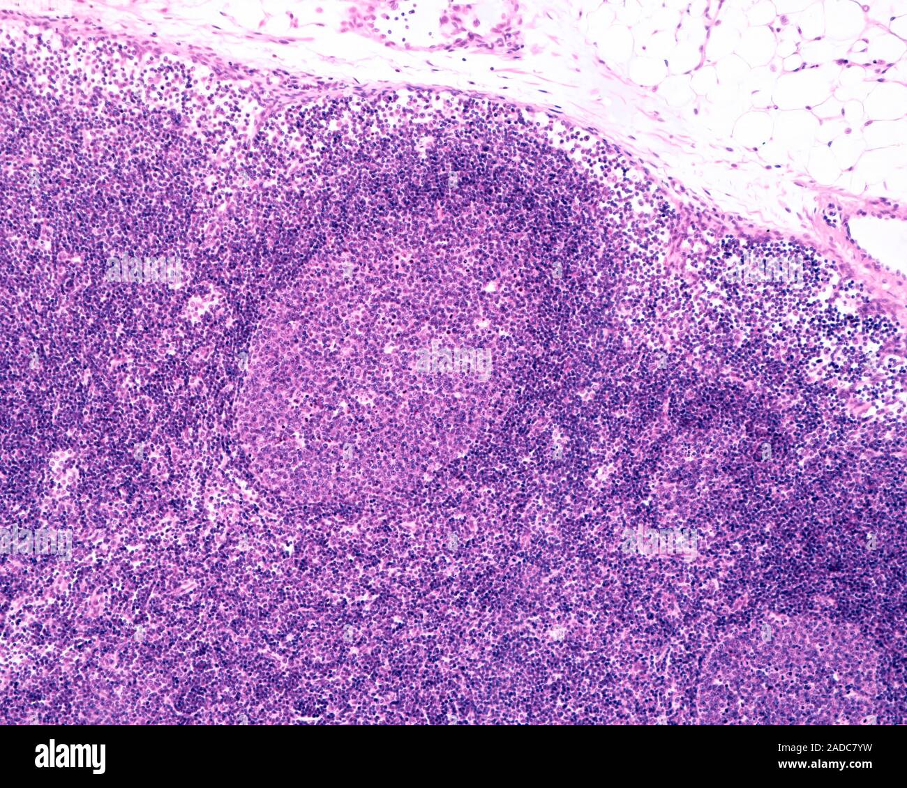 Light micrograph of a lymph node follicle, located in the cortex of a ...