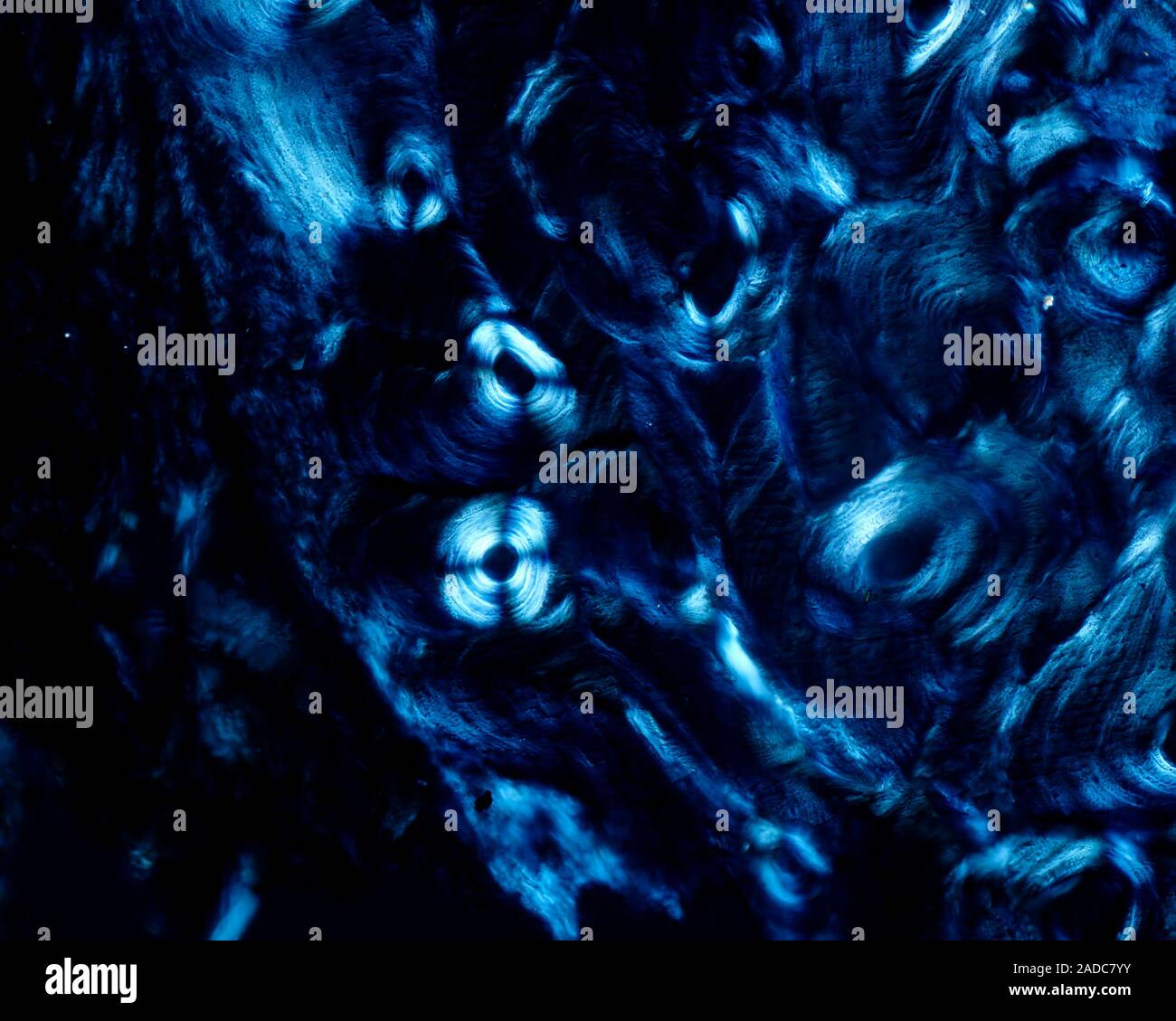 Cross-sectioned diaphysis of a long bone, viewed under a polarised ...