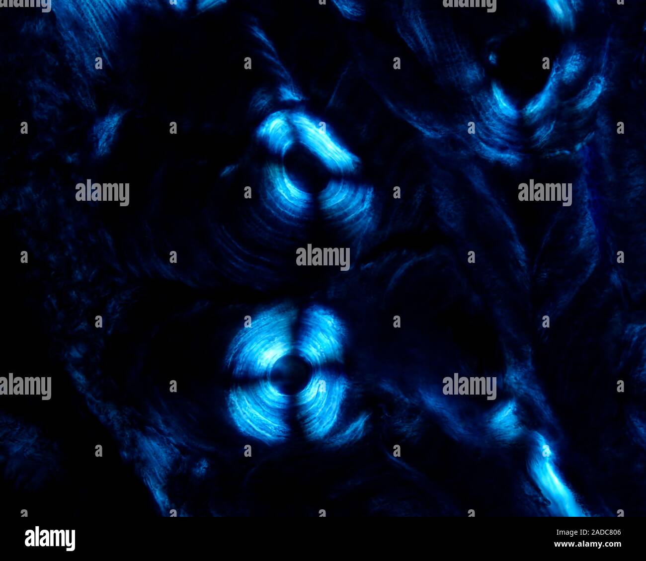 Osteons in a compact bone seen with polarized light microscope. Osteons ...
