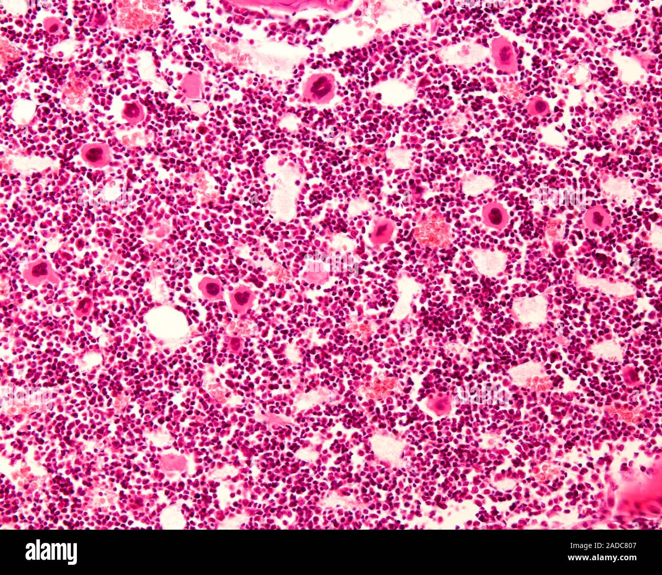 Light micrograph of a section through red bone marrow tissue. It ...