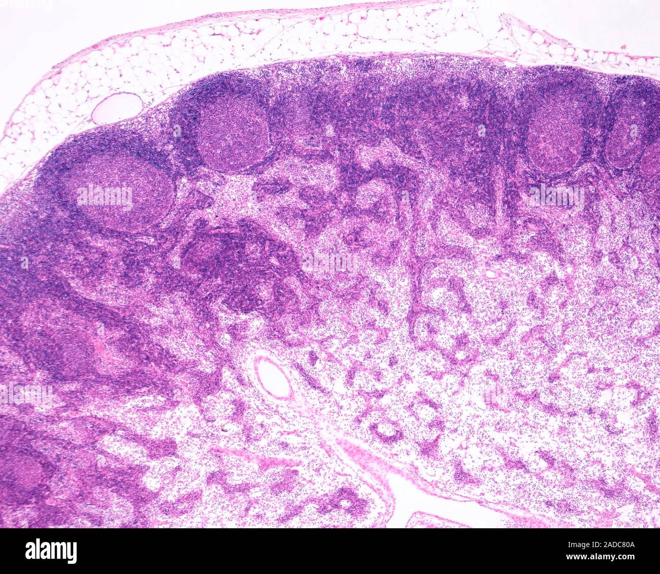Low magnification light micrograph of a lymph node showing a peripheral ...