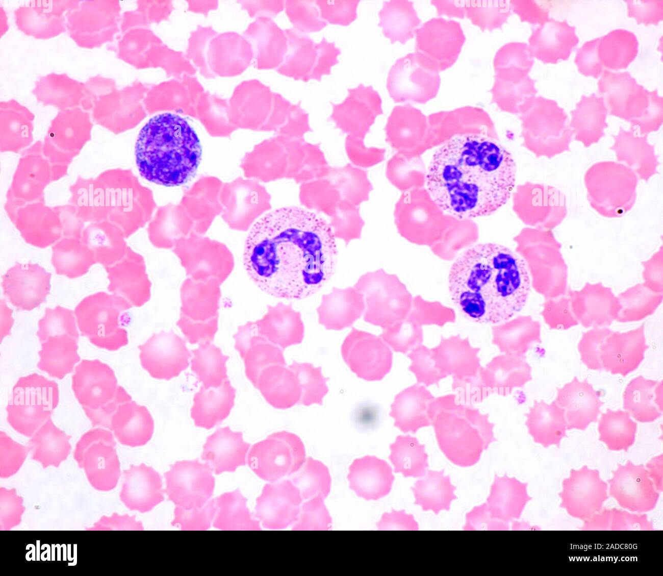 Blood smear, light micrograph. Among the erythrocytes, or red blood ...