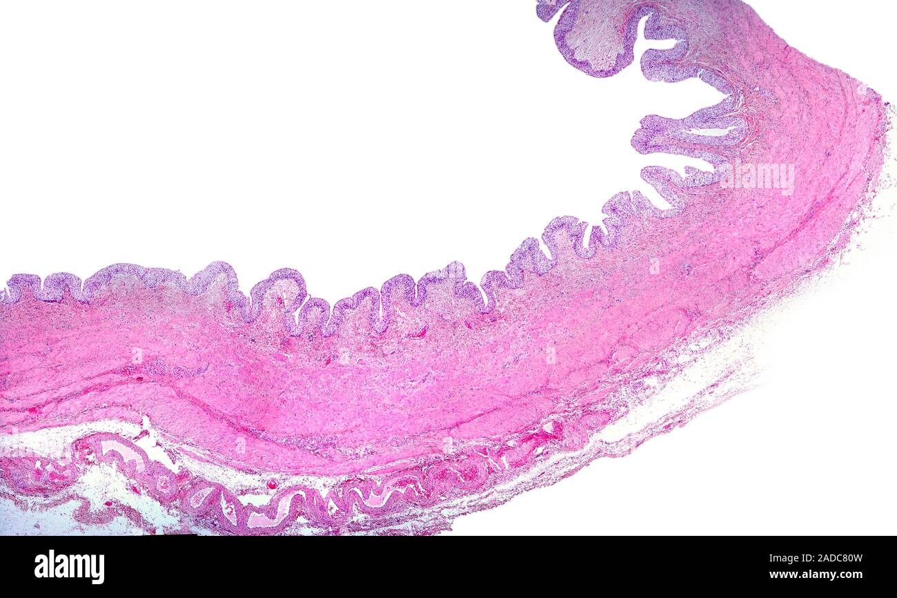 Low magnification light micrograph of a urinary bladder wall. At the ...