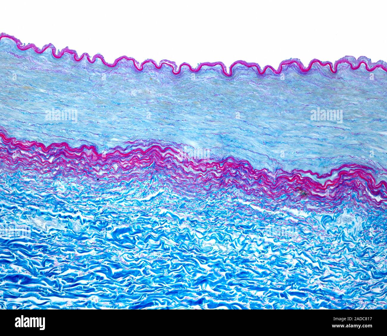 Light micrograph of a muscular artery stained with the Cajal-Gallego's ...