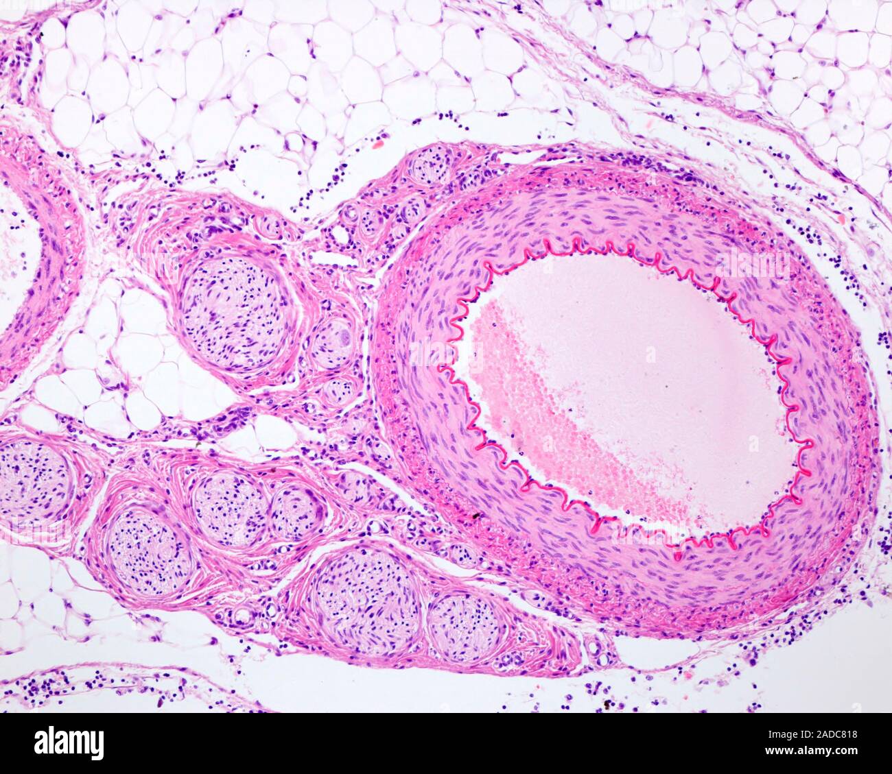 Light micrograph of fascicles of nerve fibres near to a muscular artery ...