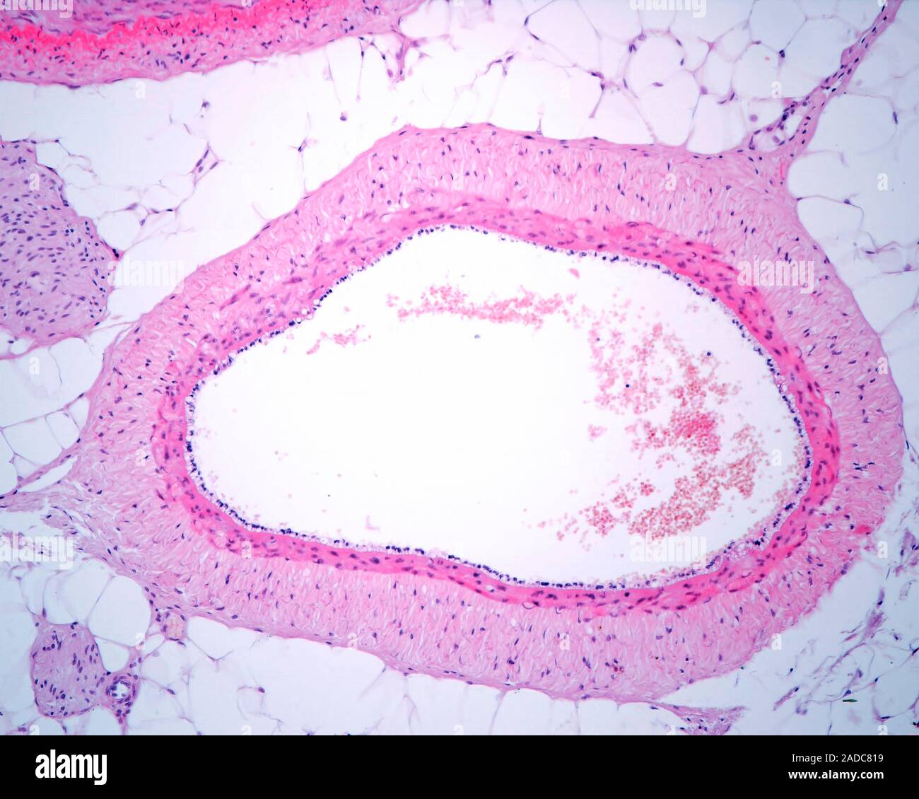 Cross section of a median sized vein, light micrograph. Their layers ...