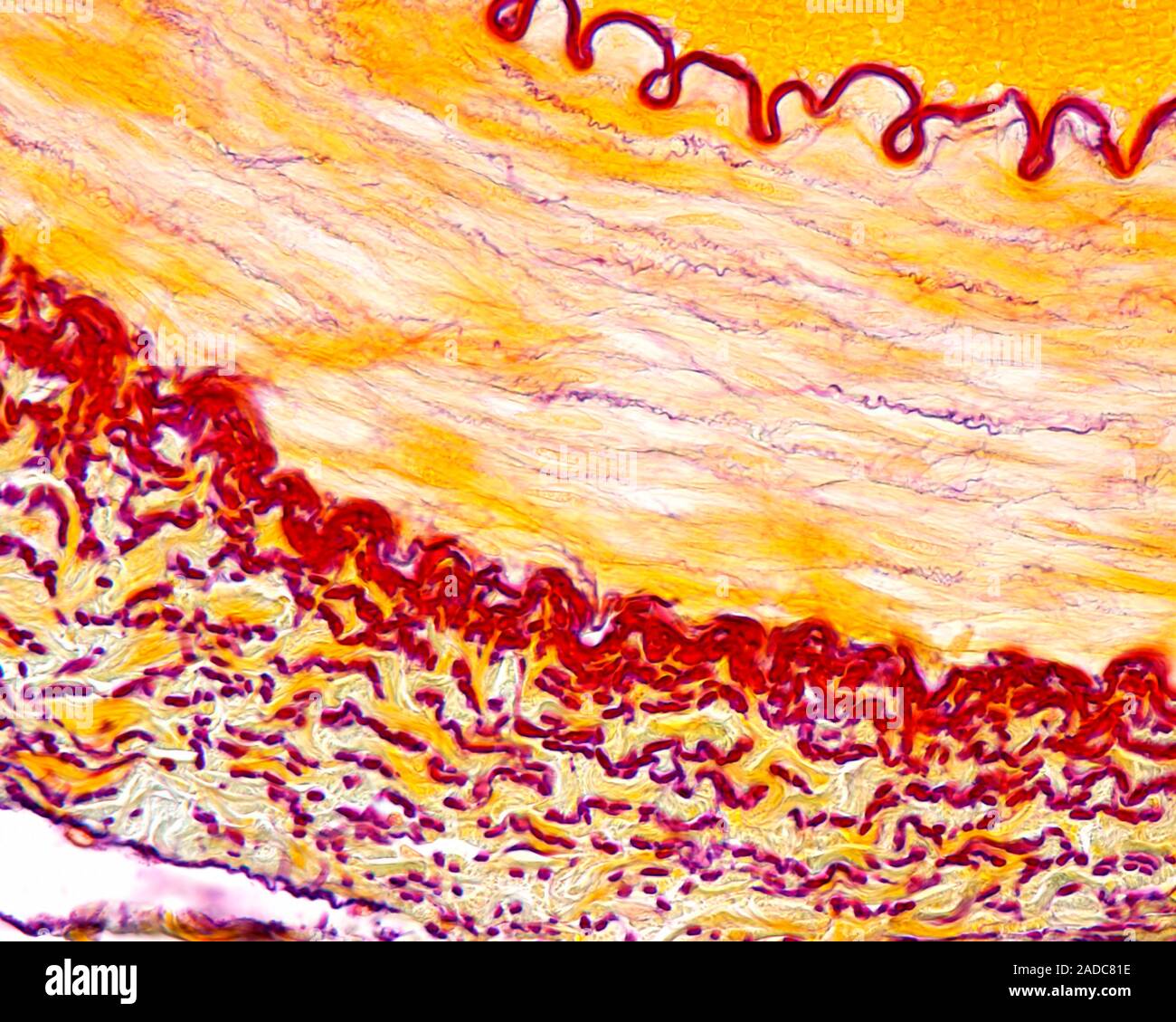 Light micrograph of a cross-sectioned muscular artery stained with Gabe ...