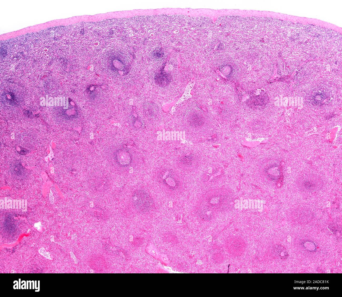 Low magnification light micrograph of a human spleen. The surface of ...