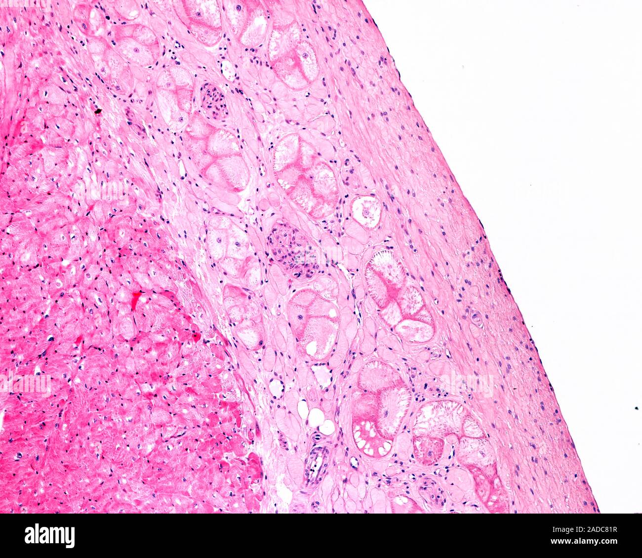 Light micrograph of fibres of the heart conduction system located in ...