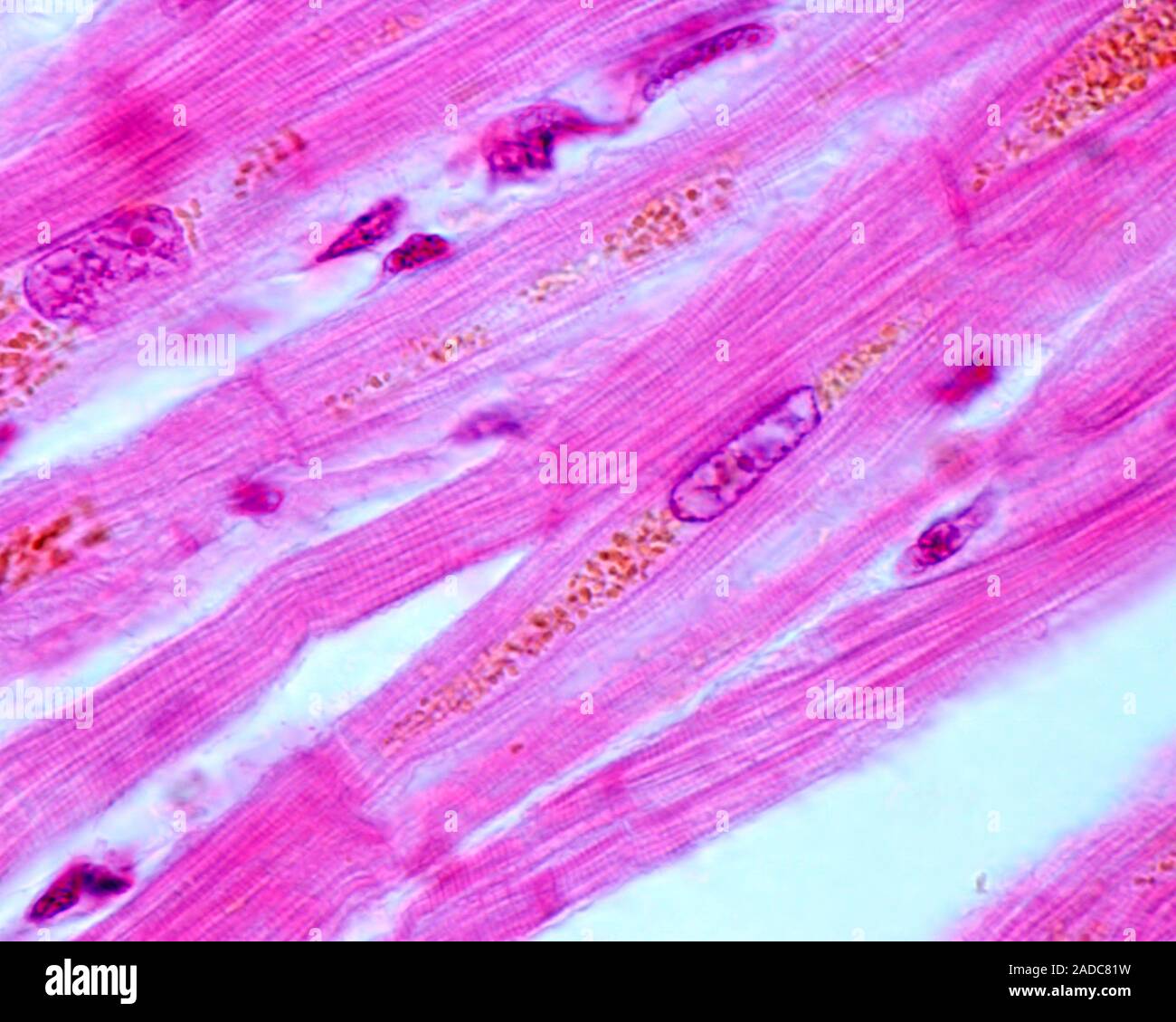 High magnification light micrograph showing heart myocytes ...