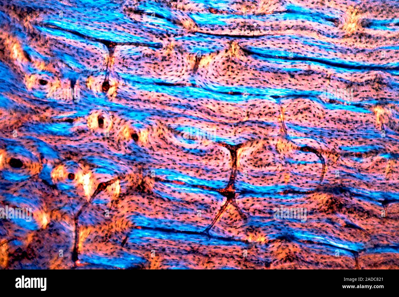 Compact bone seen with polarized light microscope. To the left of the ...