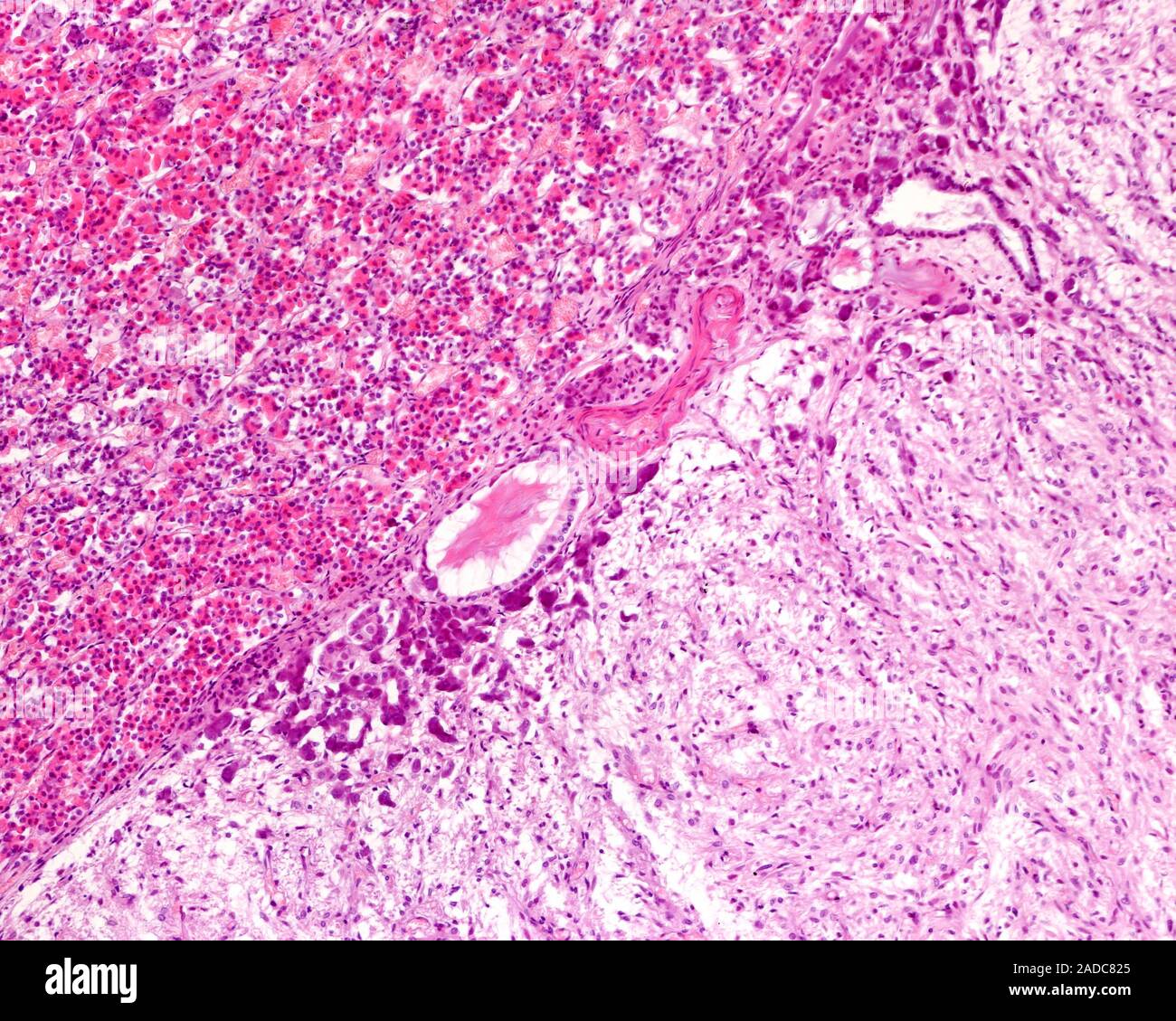 Light micrograph of the intermediate lobe, or pars intermedia, of a ...