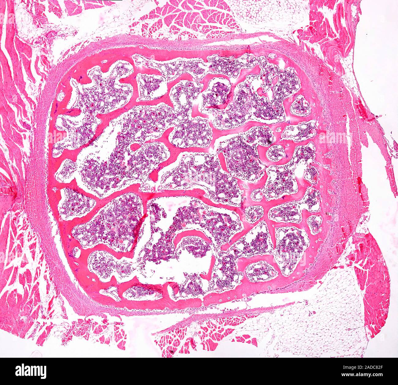Light micrograph showing a short bone in cross section. The bone is ...