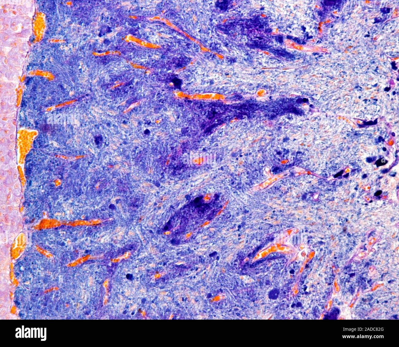 Light micrograph of neurosecretion in the posterior lobe of the ...