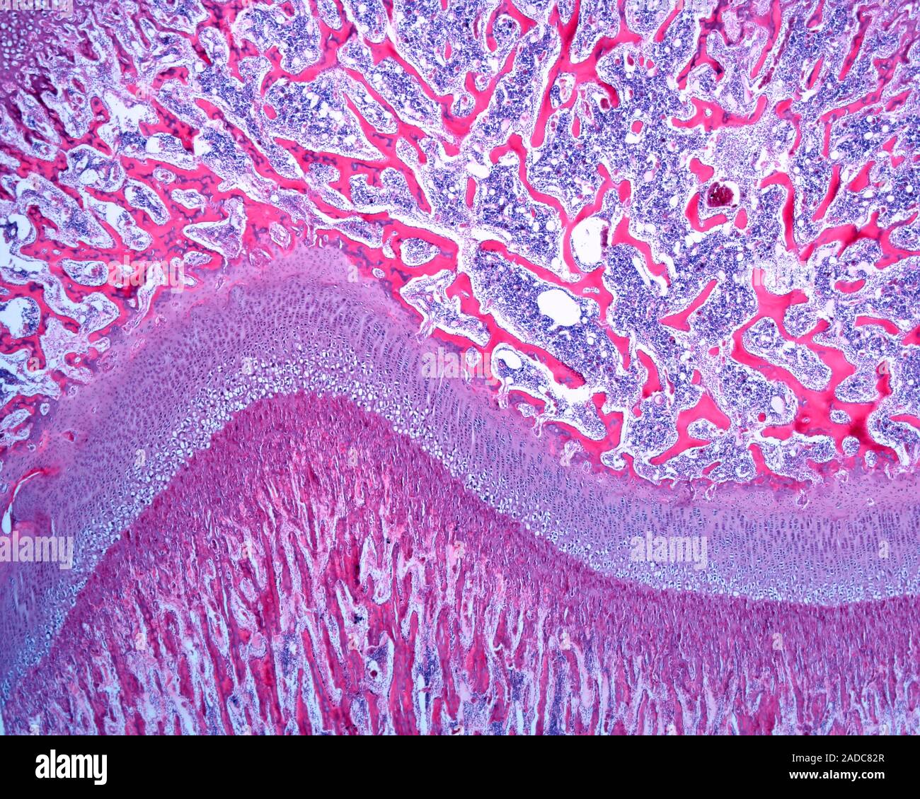 Low magnification light micrograph of the epiphyseal growth plate of a ...