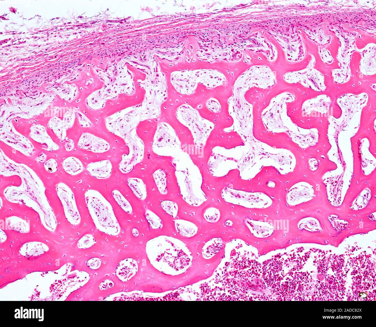 Peripheral area of the diaphysis (shaft) of an embryonic bone, light ...
