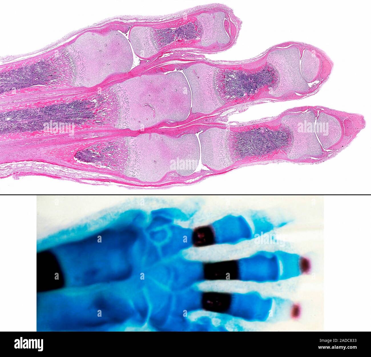 Light micrographs of embryo hand bones in the process of ossification ...