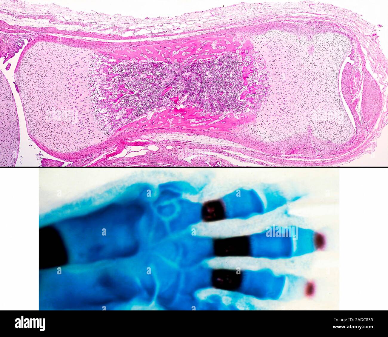 Long bone in process of ossification, comparison between a micrograph ...