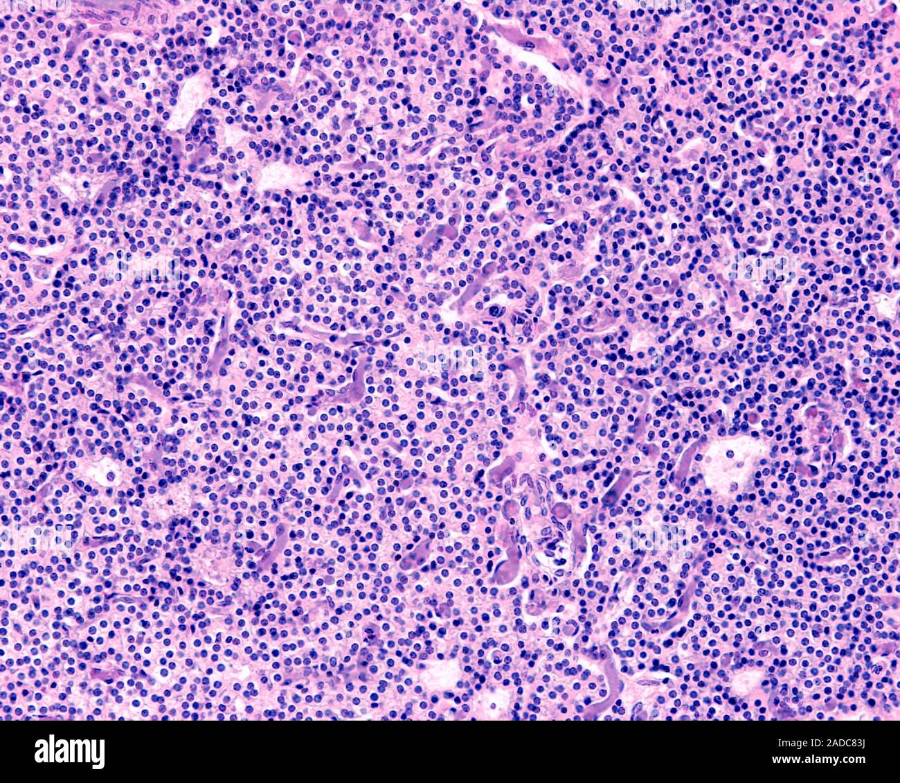 Parathyroid gland of a child, light micrograph. Unlike other endocrine ...