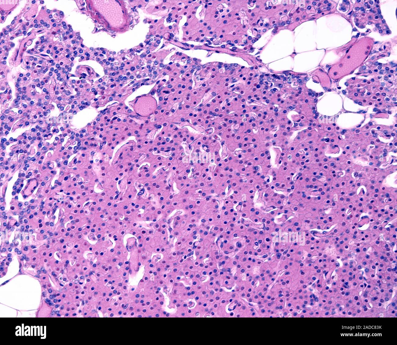Parathyroid Gland Chief Cells Histology
