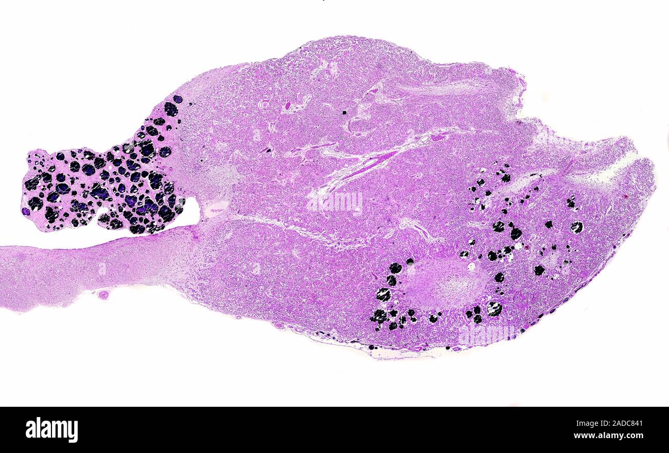 Low magnification light micrograph showing a sagittal section of a ...