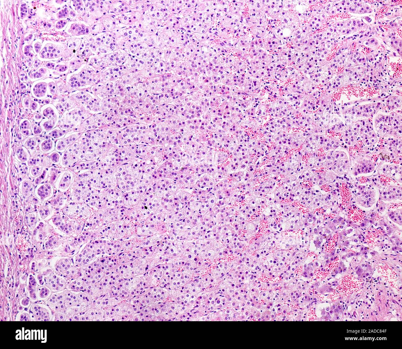 Light micrograph of the adrenal cortex showing, from left to right, the ...