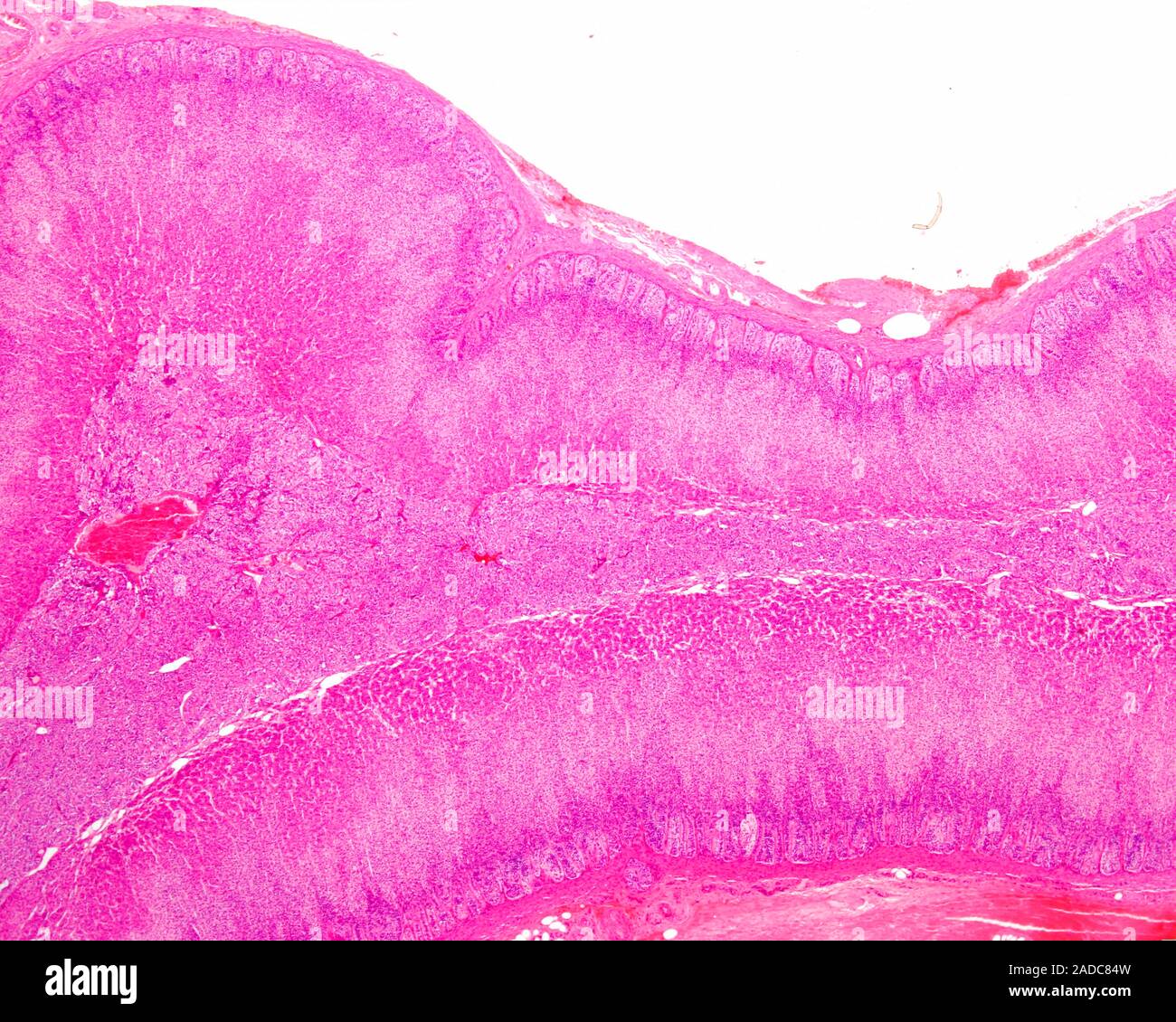 Low magnification light micrograph showing a normal adult adrenal gland ...