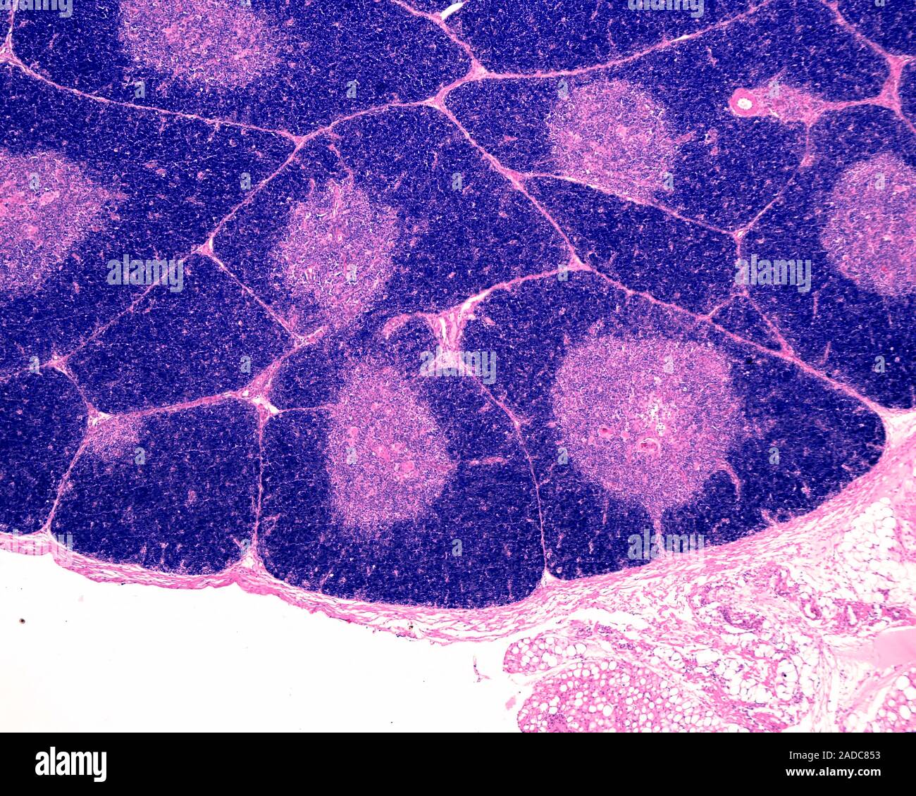 Low magnification light micrograph showing a young thymus. The ...