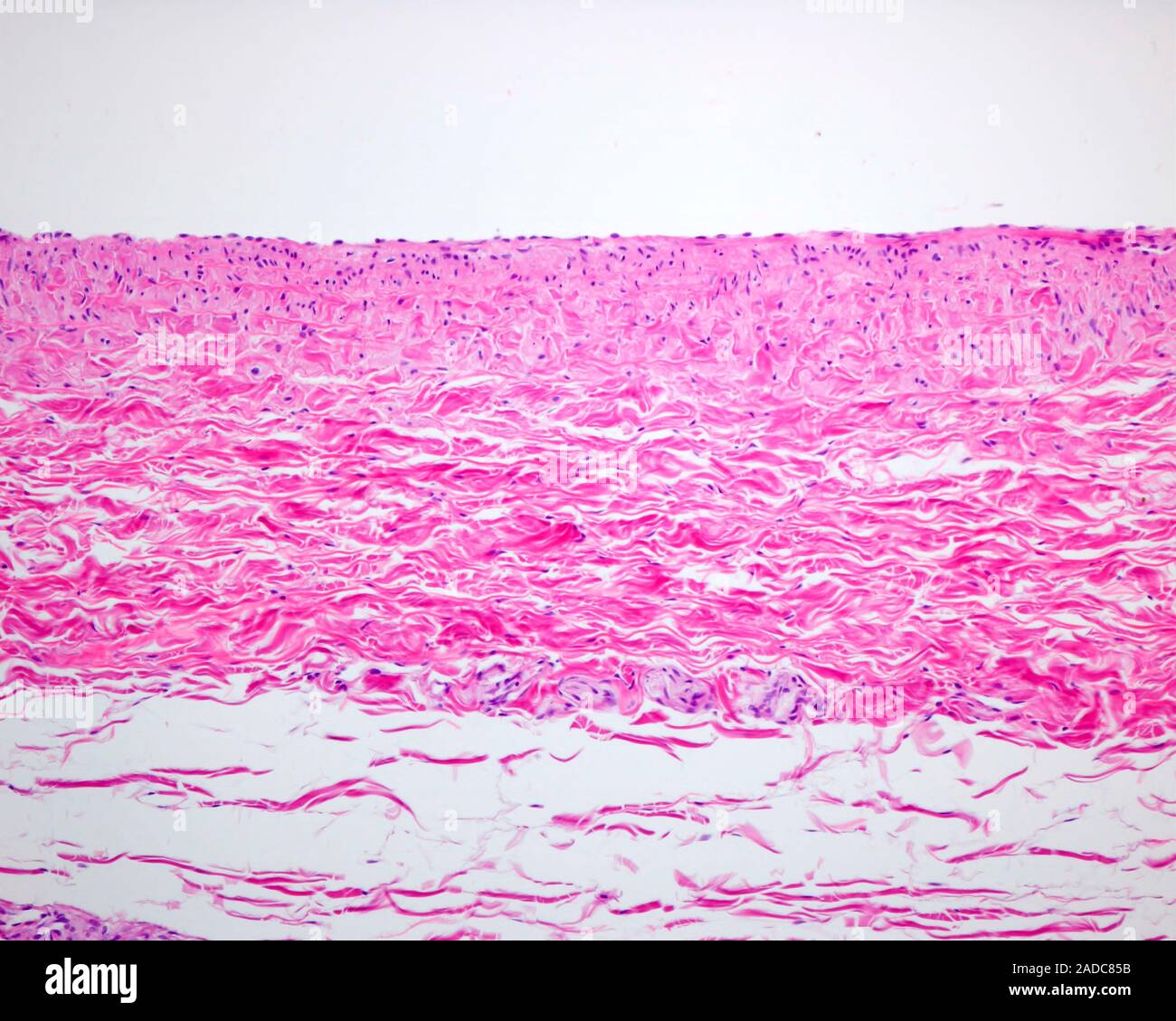 Light micrograph of a longitudinal section of a large vein stained with ...